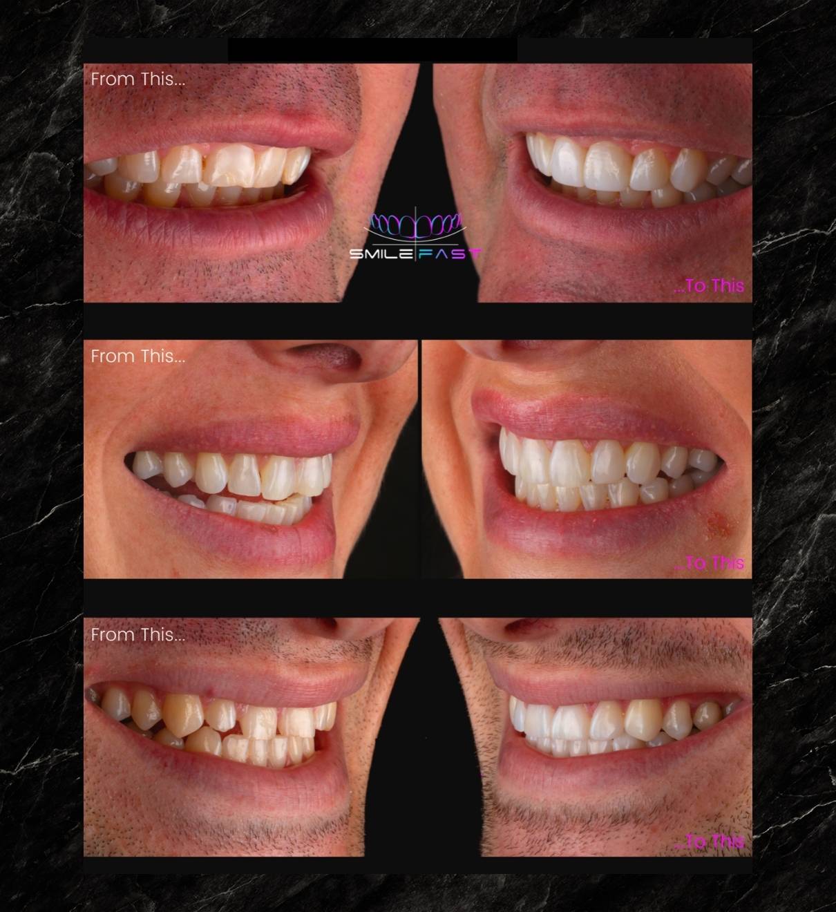 SmileFast - Southport Road Dental
